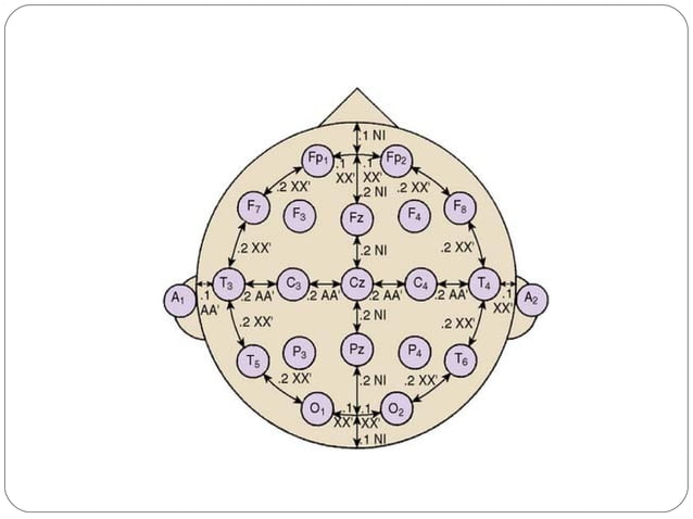 10 and 20 electrode placement | PPT | Brain and Nervous System ...