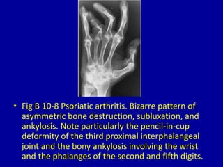 10 arthritides CLINICAL IMAGAGING AN ATLAS OF DIFFERENTIAL DAIGNOSIS ...