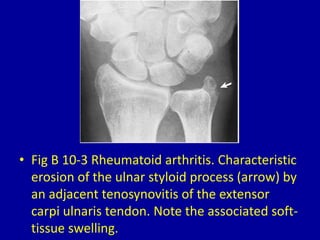 10 arthritides CLINICAL IMAGAGING AN ATLAS OF DIFFERENTIAL DAIGNOSIS ...