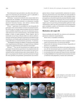 10 articulo revision de los principios de las cavidades dentales 2008 | PDF