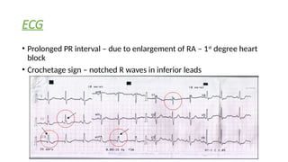 10 – Atrial septal defects Zeeshan.pptx