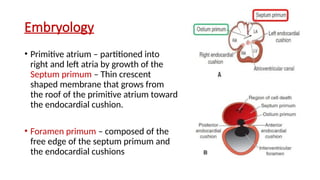 10 – Atrial septal defects Zeeshan.pptx