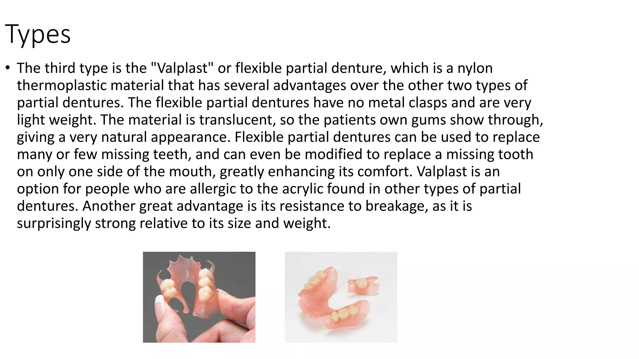 removable partial dentures | PPTX