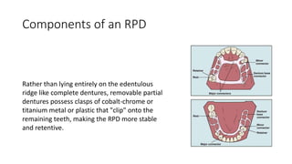 removable partial dentures | PPTX