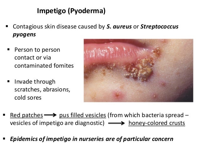 10 bio265 disease of skin and cns instructor dr di bonaventura