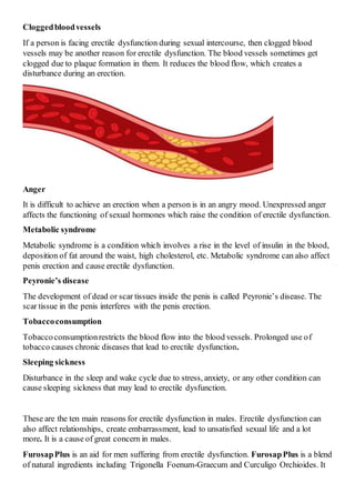 10 causes of ed | DOCX