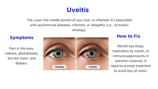 10 Common Eye Diseases You Should Know About | PDF