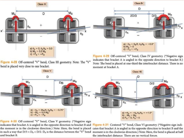 determinate vs indeterminate force system | PPTX | Dental Health ...