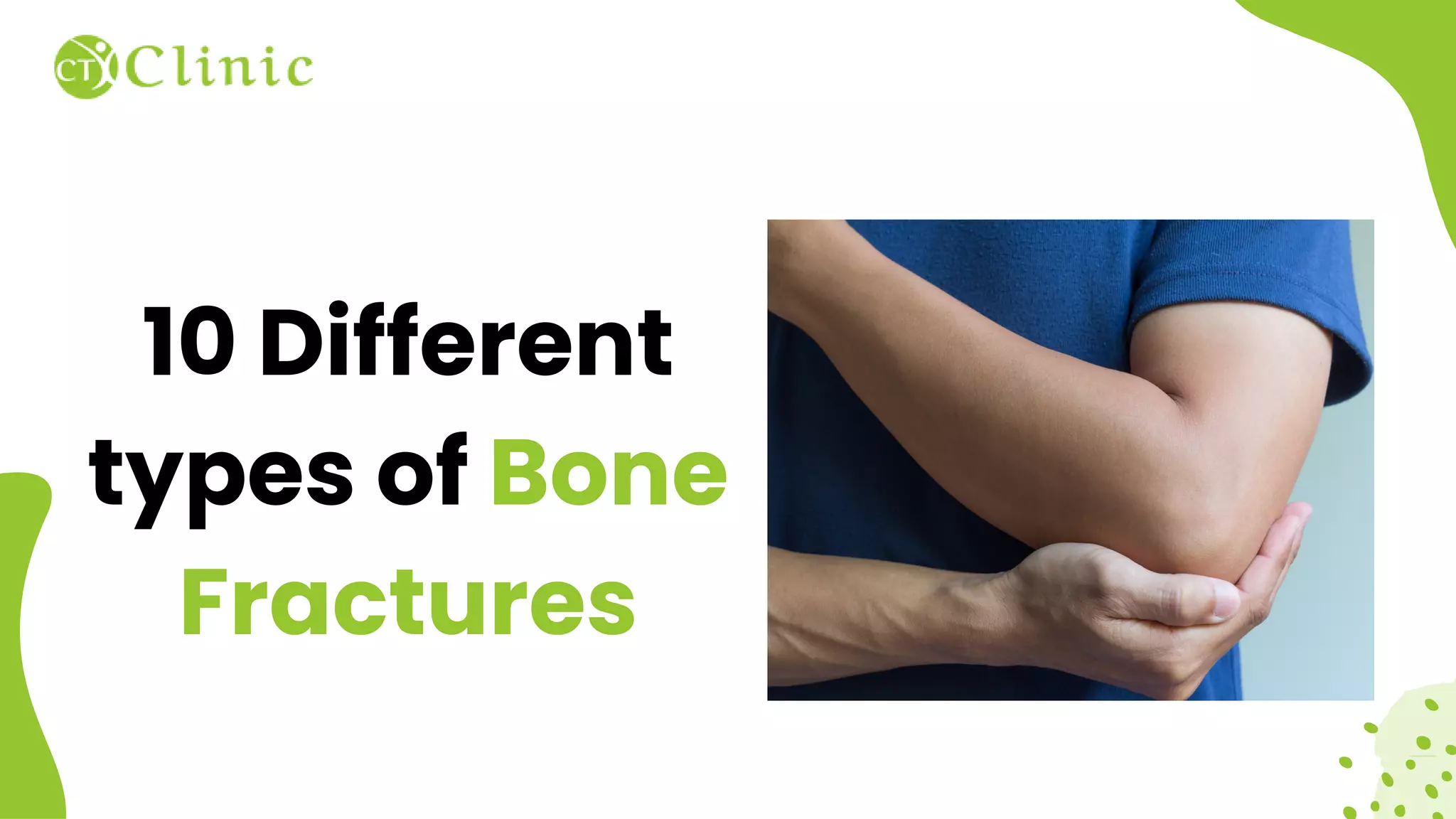 10 Different types of Bone Fractures.pdf