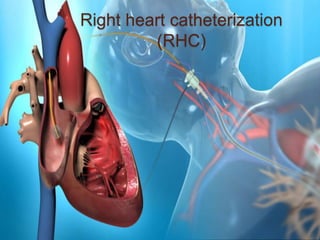 Pulmonary Arterial Hypertension (PAH) presentation | PPTX