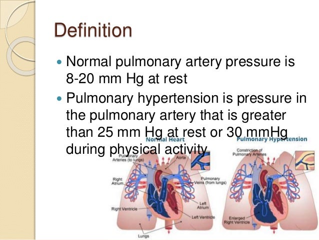 Pulmonary Arterial Hypertension (PAH) presentation