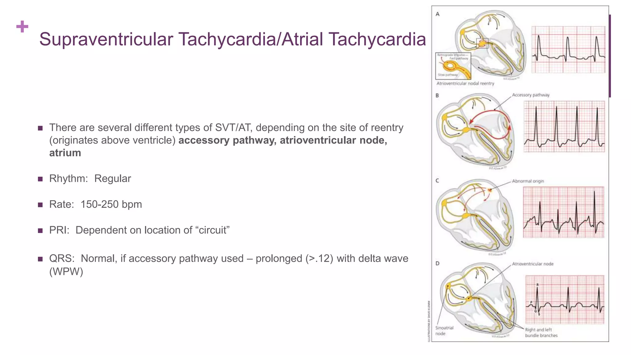 10 ECG interpret topic 10.pptx