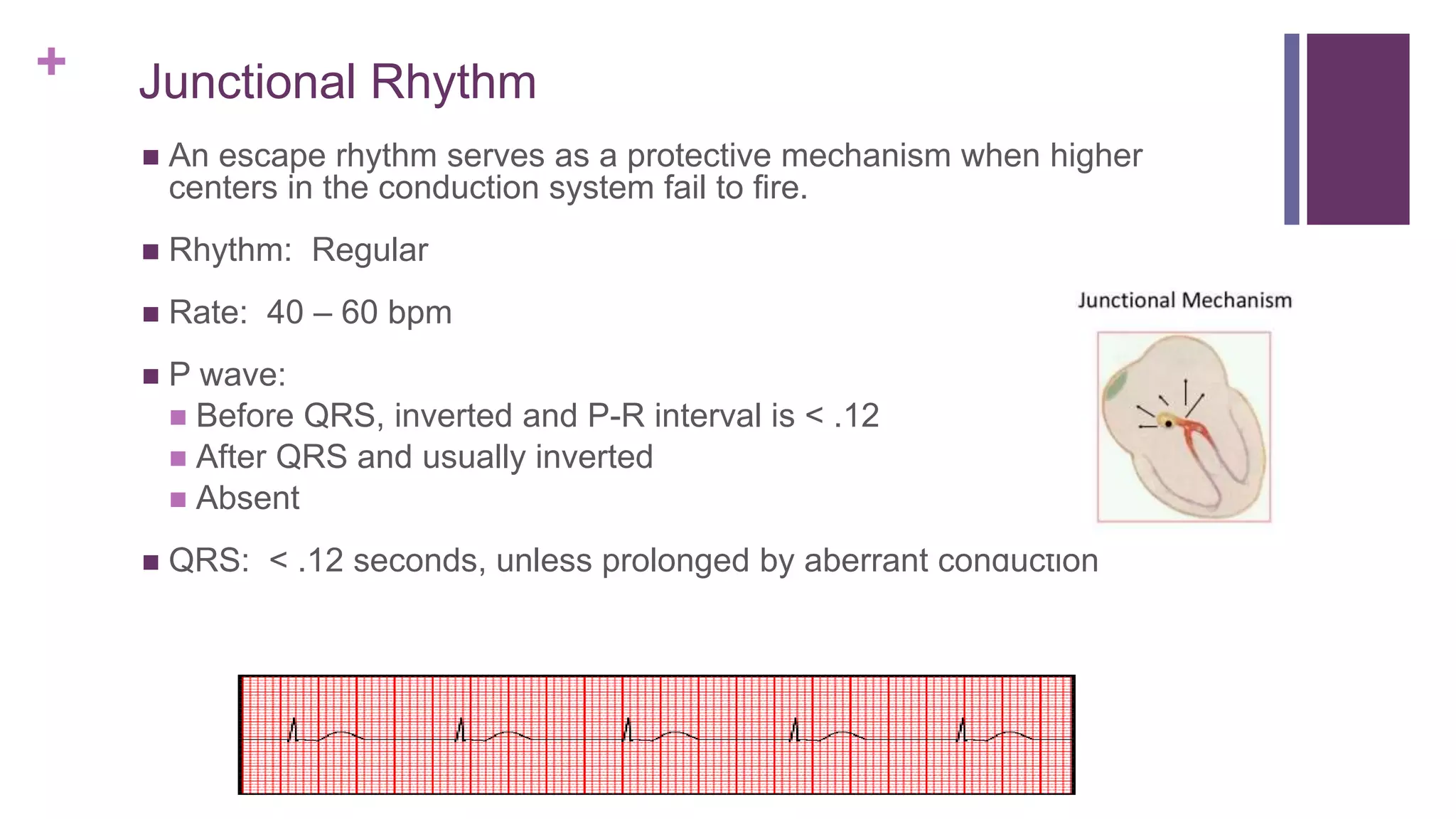 10 ECG interpret topic 10.pptx