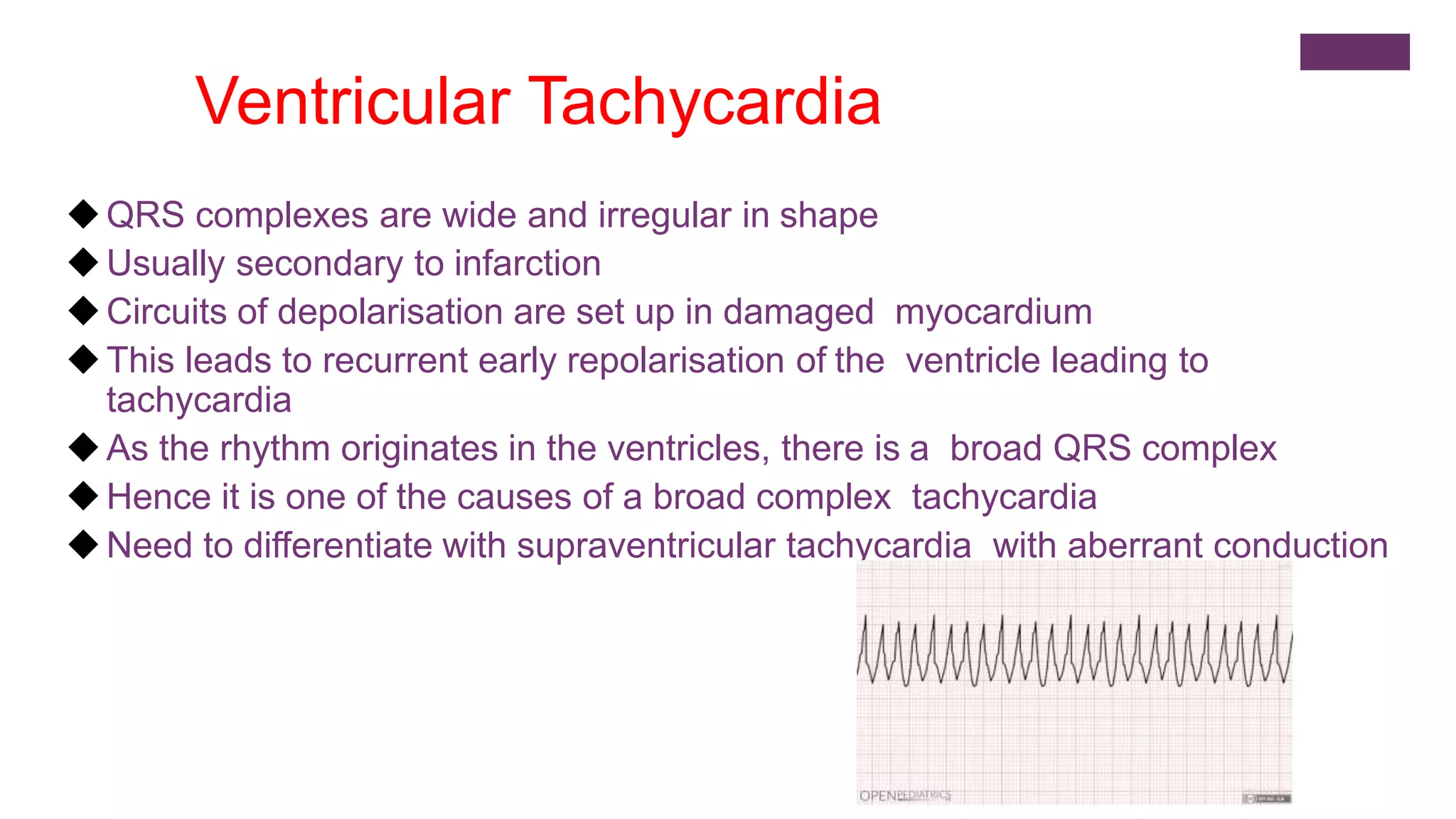 10 ECG interpret topic 10.pptx