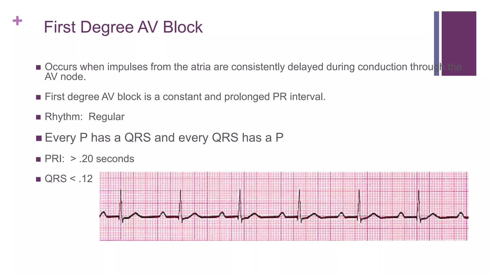 10 ECG interpret topic 10.pptx
