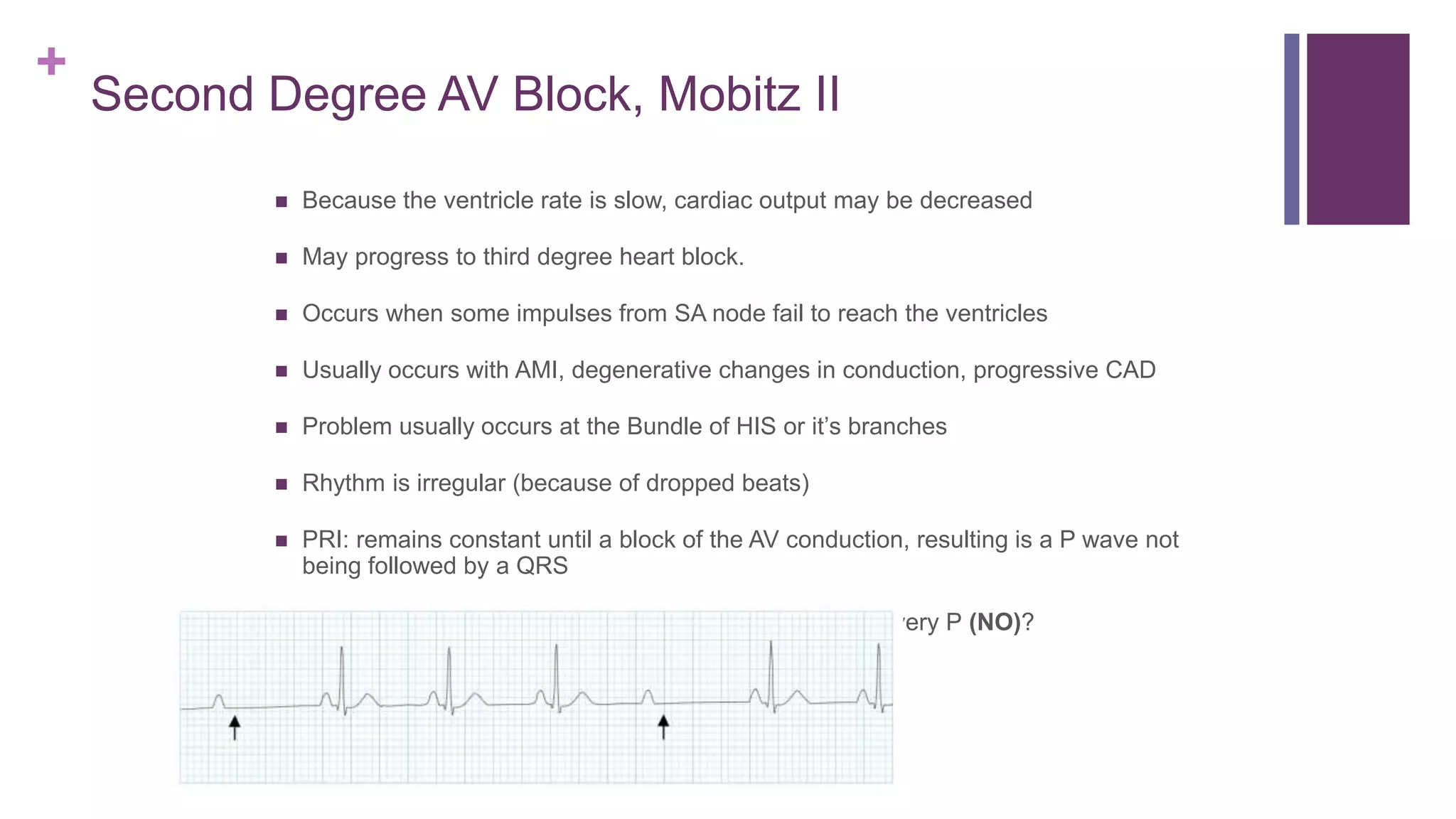 10 ECG interpret topic 10.pptx