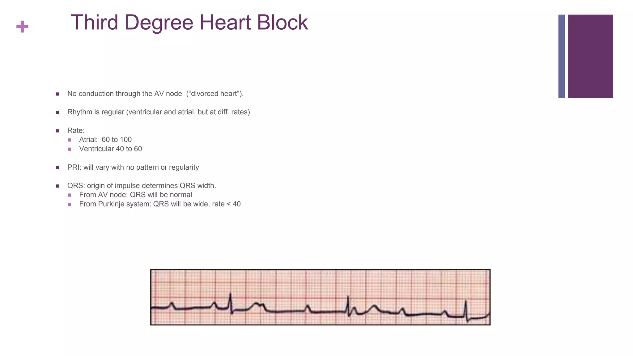 10 ECG interpret topic 10.pptx