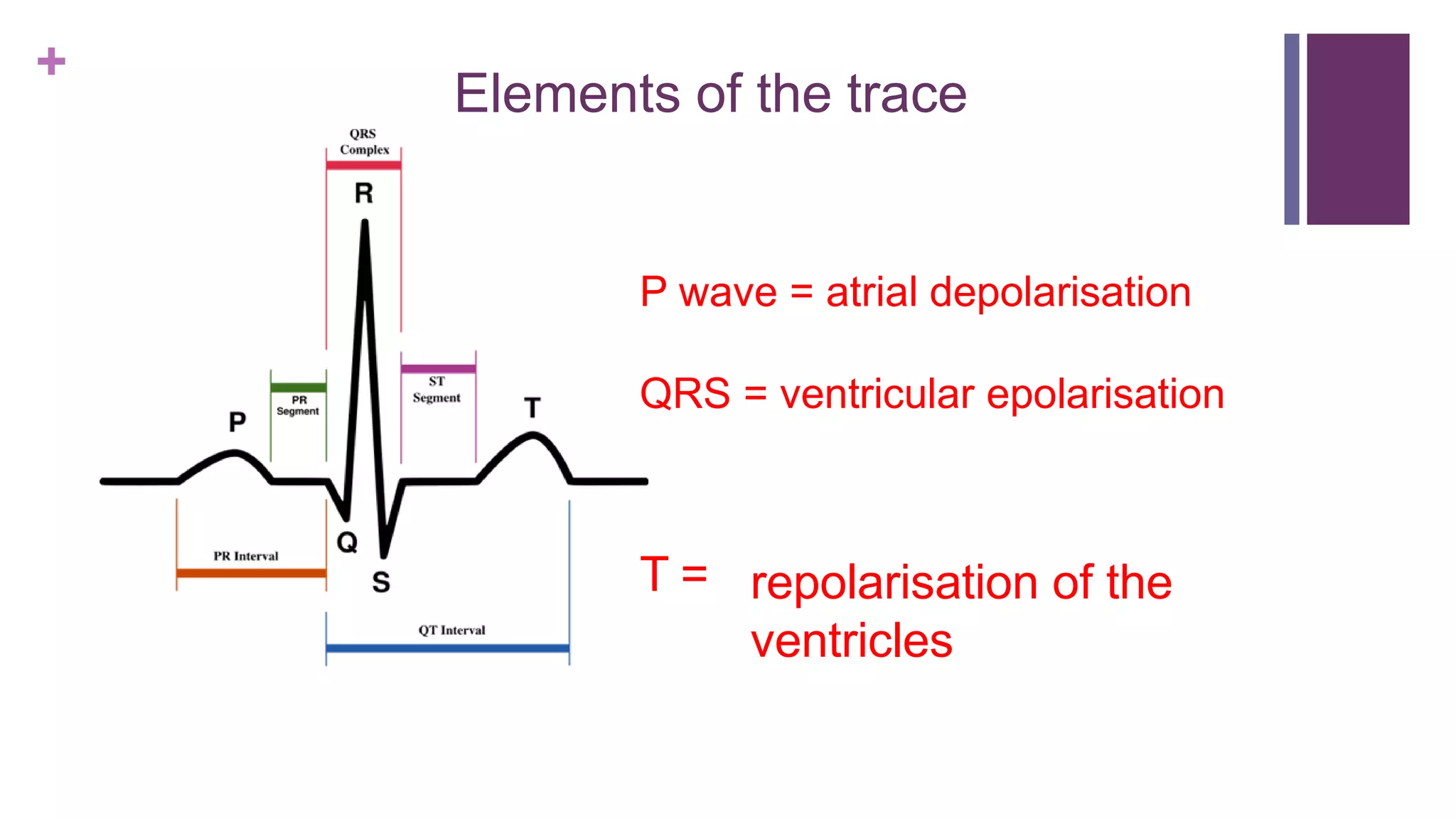 10 ECG interpret topic 10.pptx