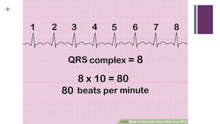 10 ECG interpret topic 10.pptx