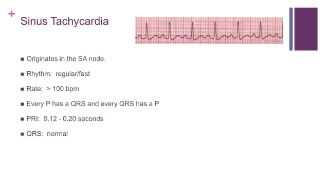 10 ECG interpret topic 10.pptx