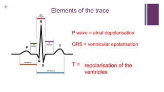 10 ECG interpret topic 10.pptx