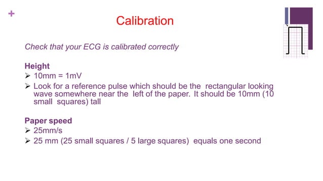 10 ECG interpret topic 10.pptx