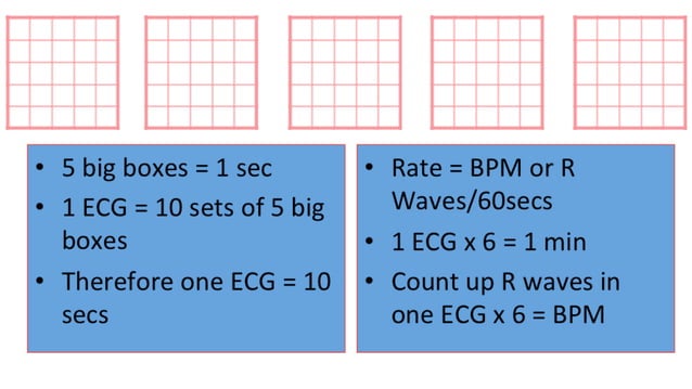 10 ECG interpret topic 10.pptx