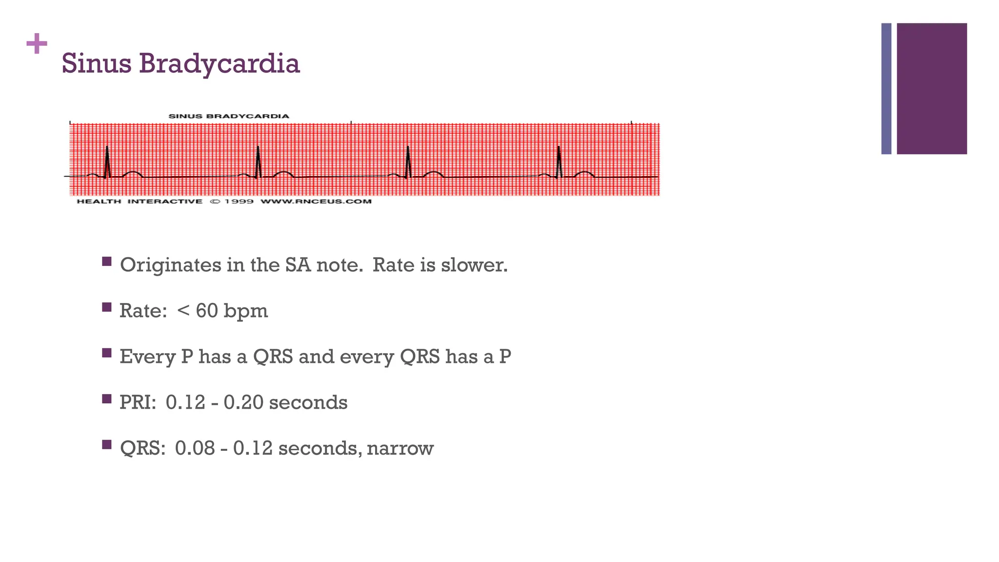 10 ECG interpret topic 10.pptx qff45g5tyy6ju7 | PPTX