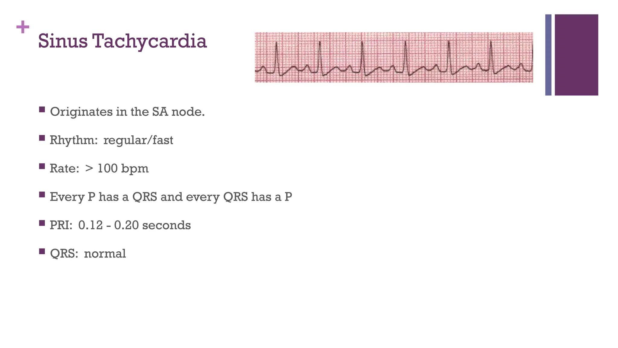 10 ECG interpret topic 10.pptx qff45g5tyy6ju7 | PPTX