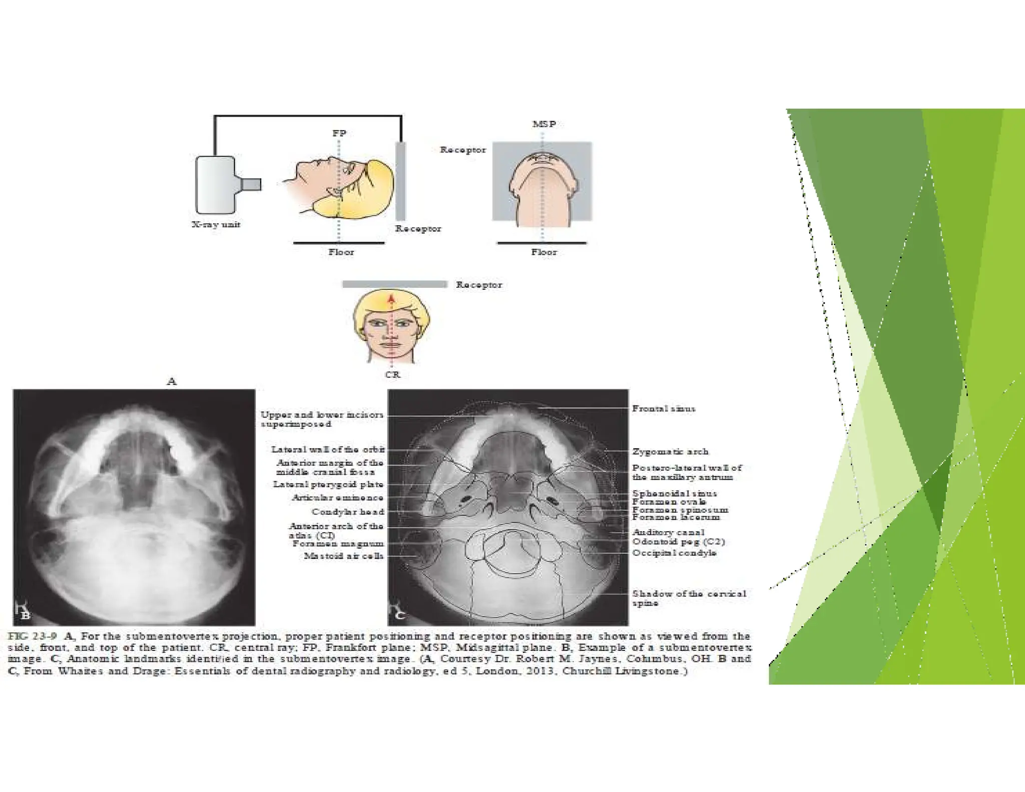10 Extraoral radiographic techniques.pdf