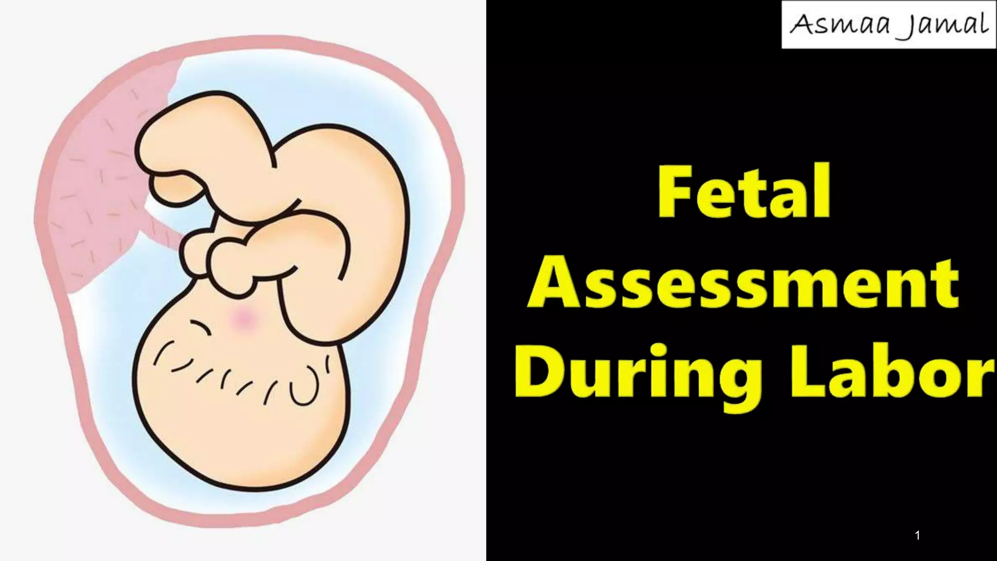 Fetal assessment | PPTX