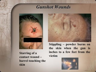 10 f forensic pathology 10 (student) | PPT