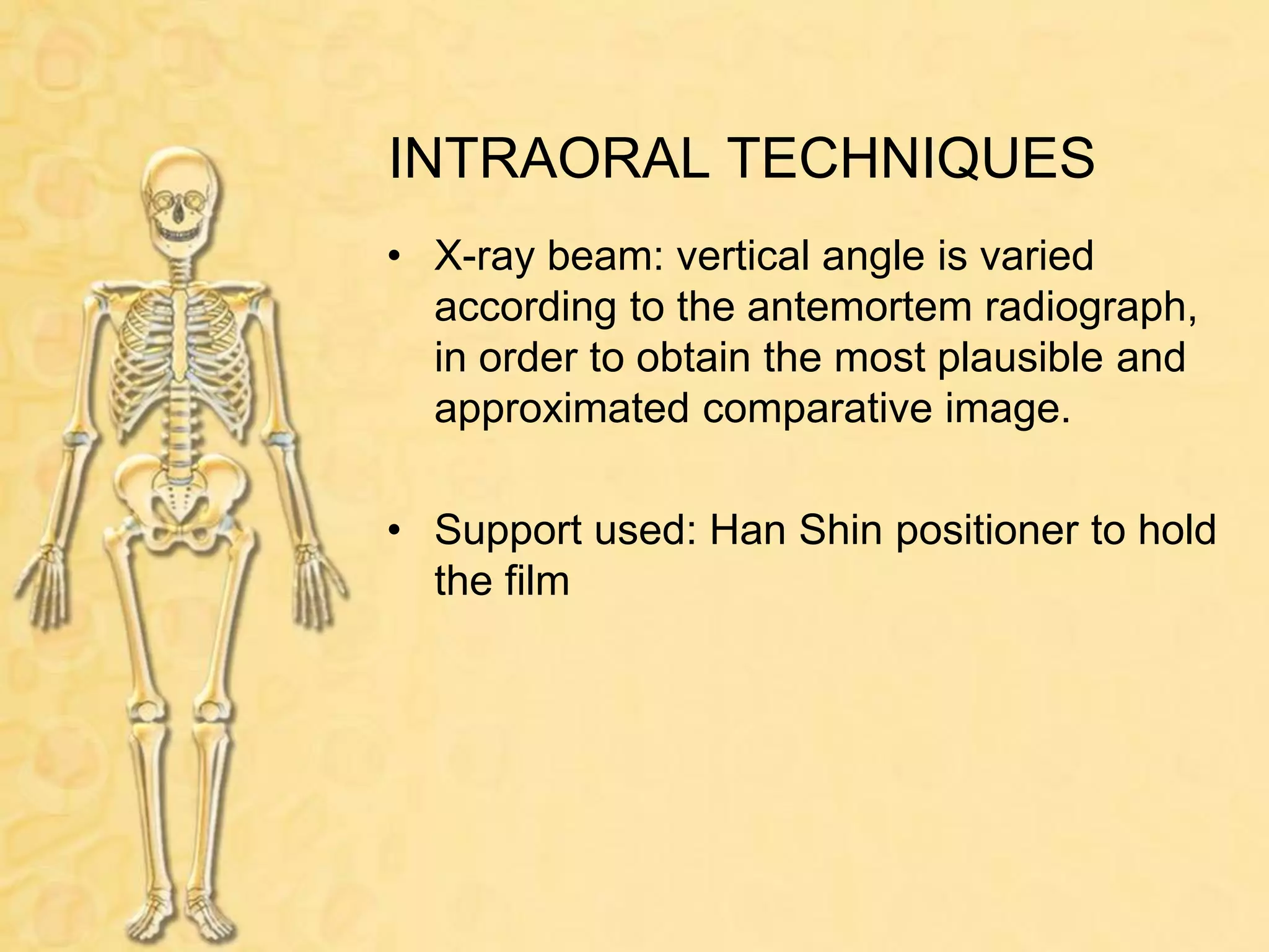 Role of Dental Radiography in Forensic Odontology | PPTX