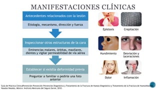 10 fractura nasal y septal | PPTX