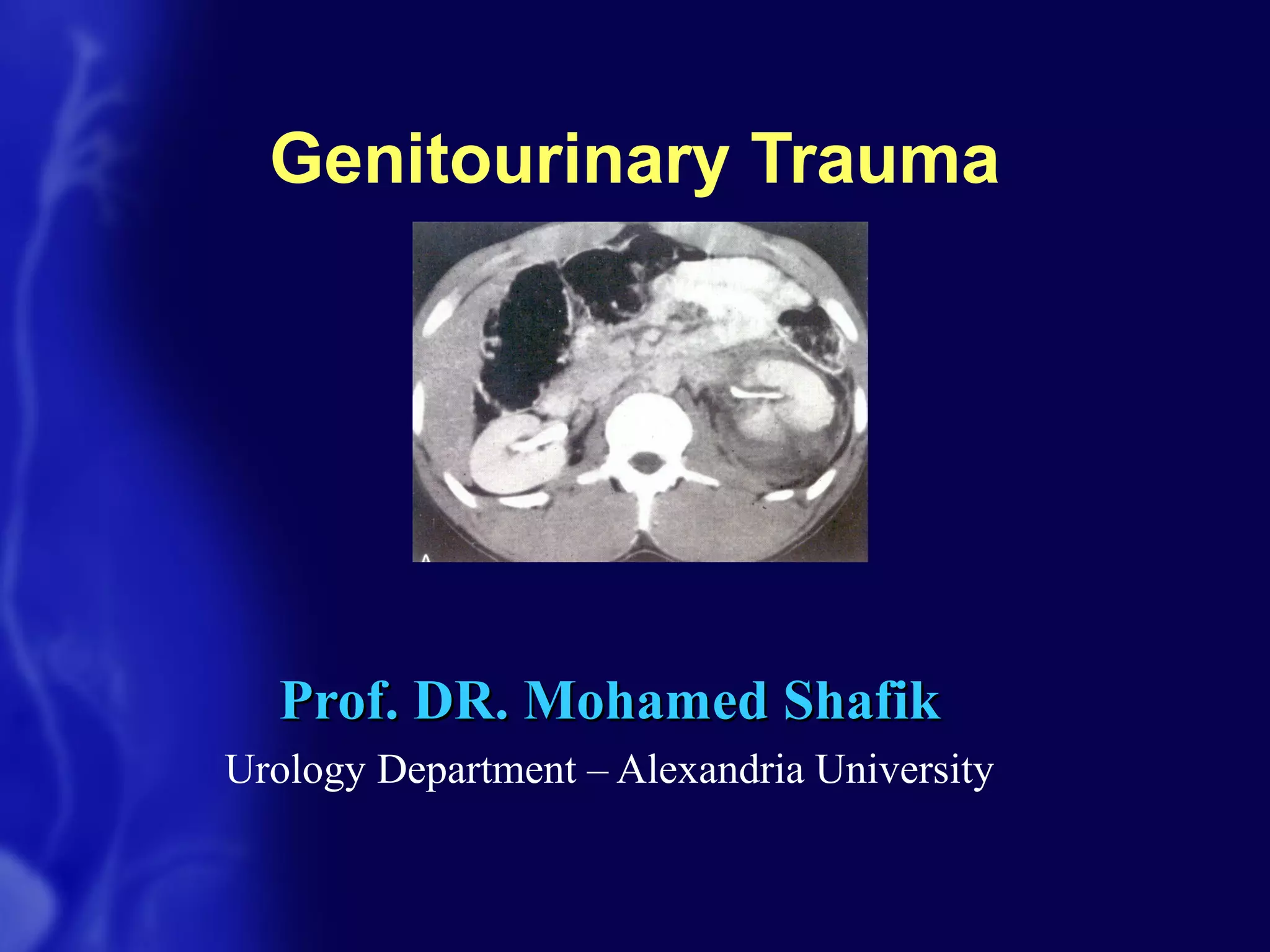 10 genitourinary trauma | PPT