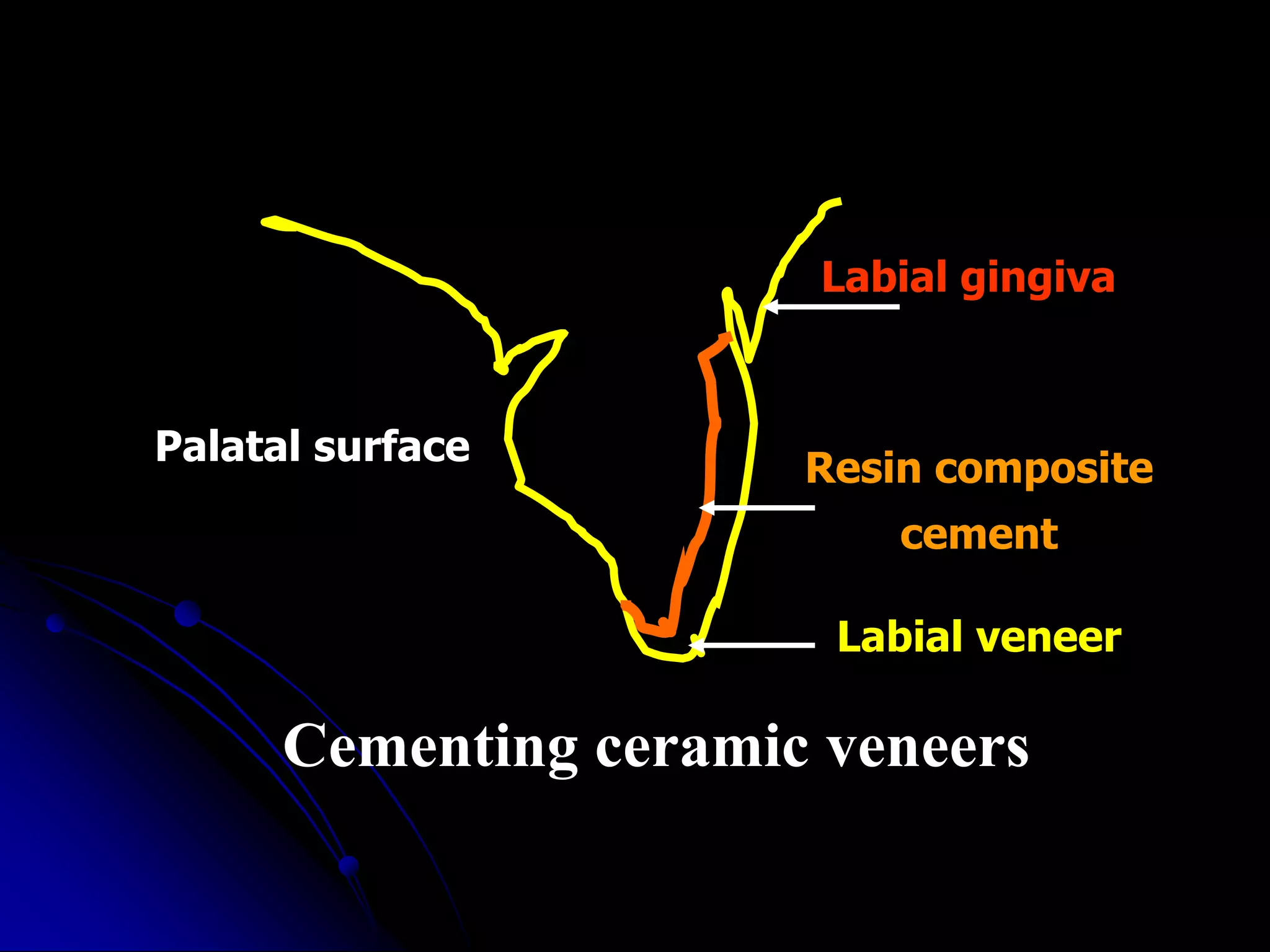 glass ionomer Metal-Modified GIC Resin-Modified GIC dental material | PPS