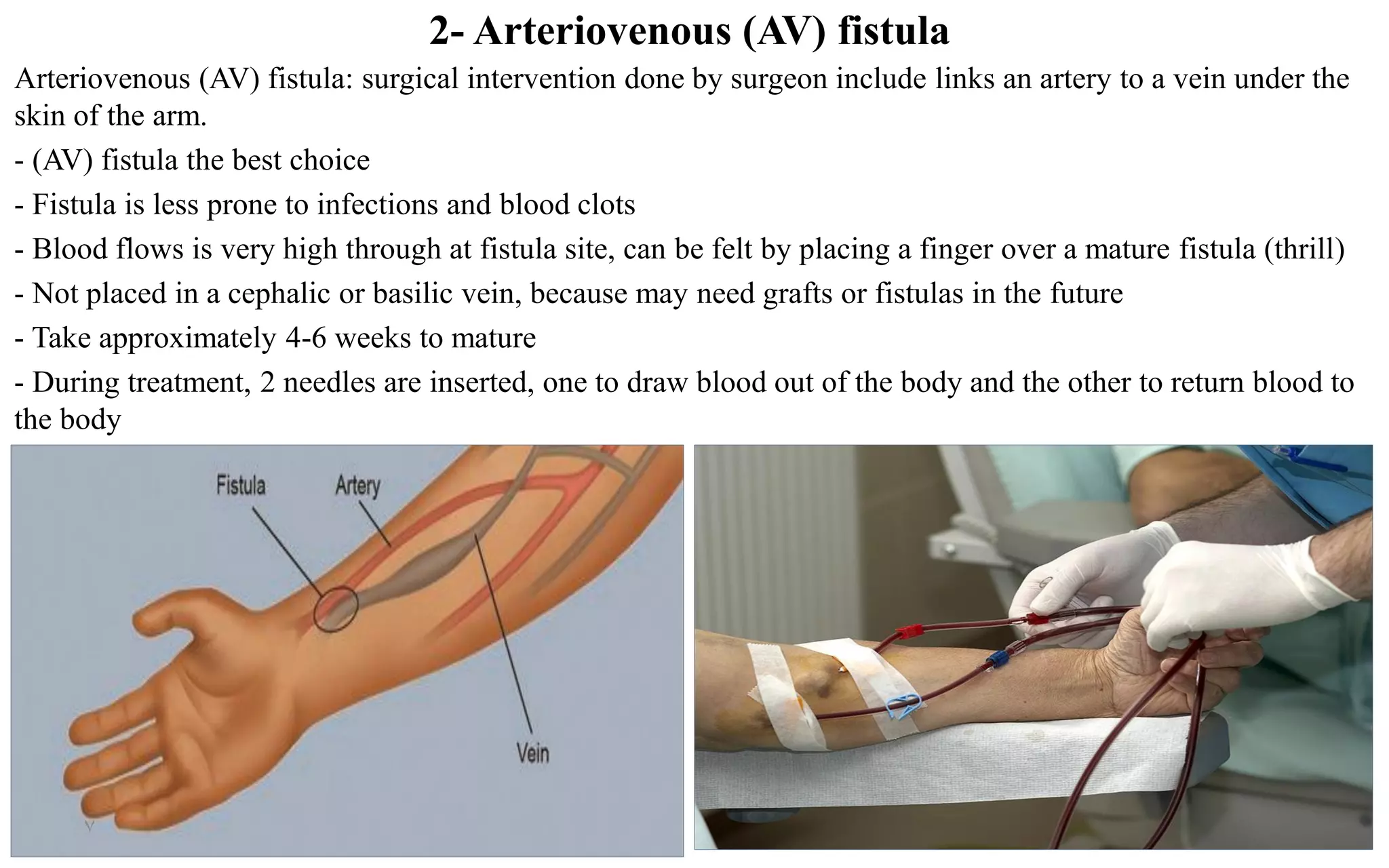 10 hemodialysis msn | PDF