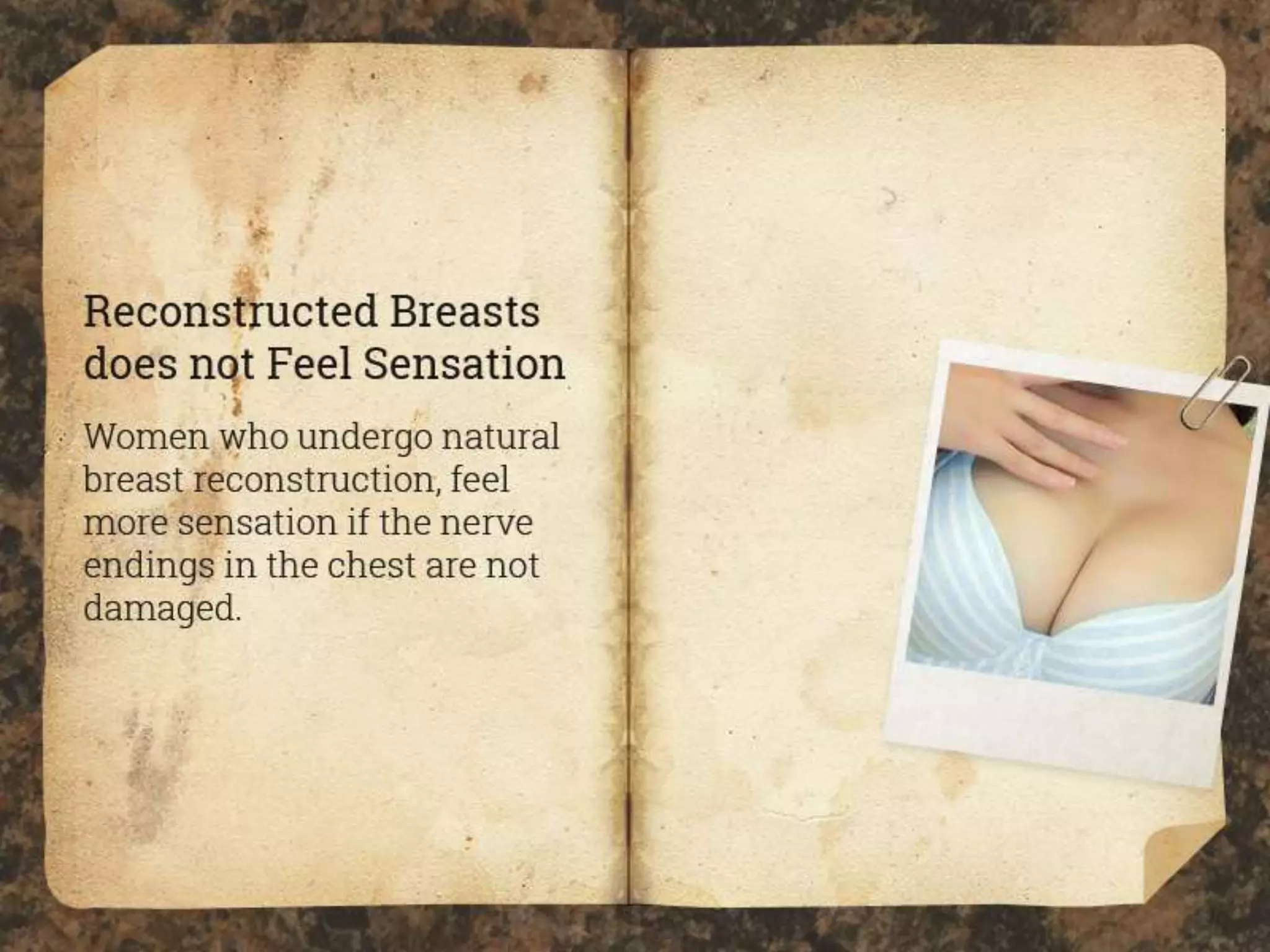 10 illusions about breast reconstruction surgery | PPTX
