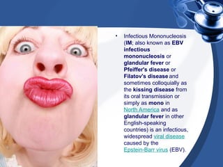 10 Infectious Mononucleosis 2 Managment.ppt