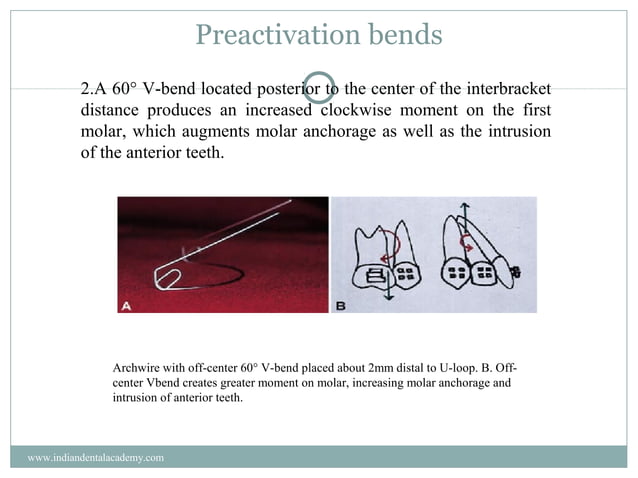K- Sir loop /certified fixed orthodontic courses by Indian dental ...