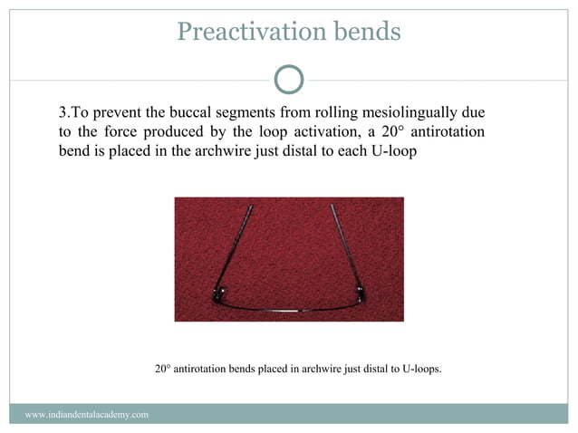 K- Sir loop /certified fixed orthodontic courses by Indian dental ...