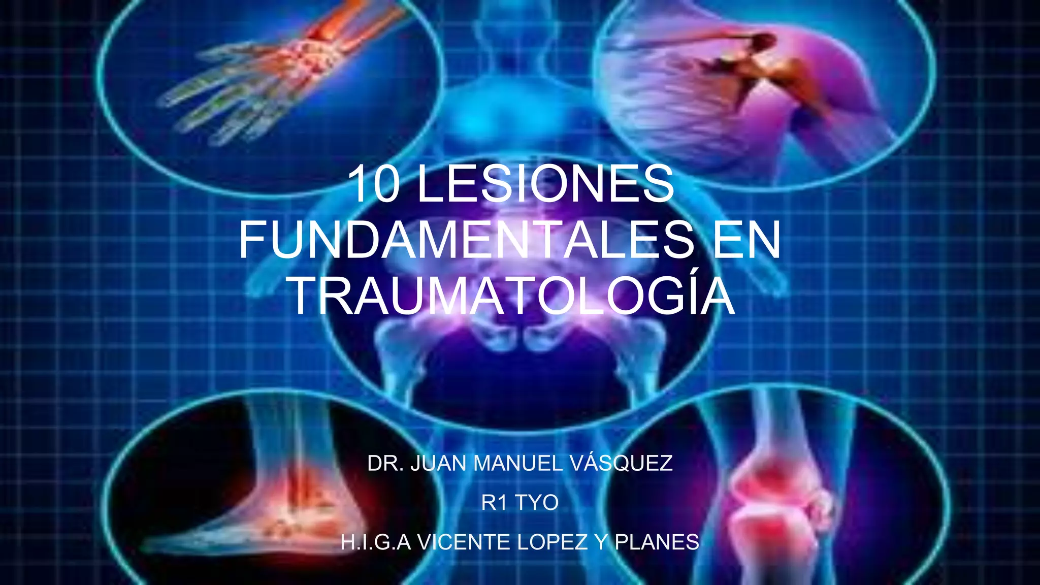 10 Lesiones Fundamentales En Traumatología 2 Pptx