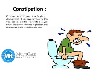 10 major causes that lead to painful symptoms of piles | PPT