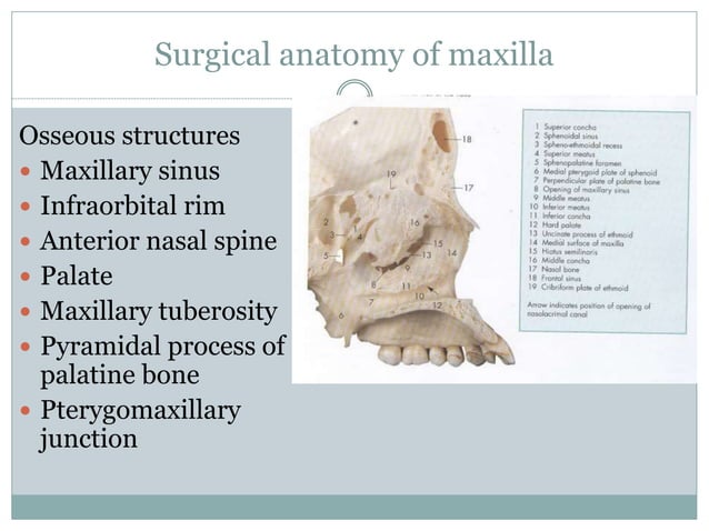 Maxillary Osteotomy Procedures | PPTX