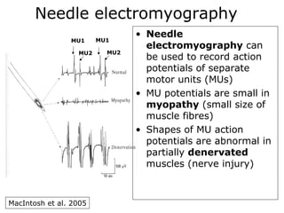 10 motor unit sr2002 2013 al | PPT