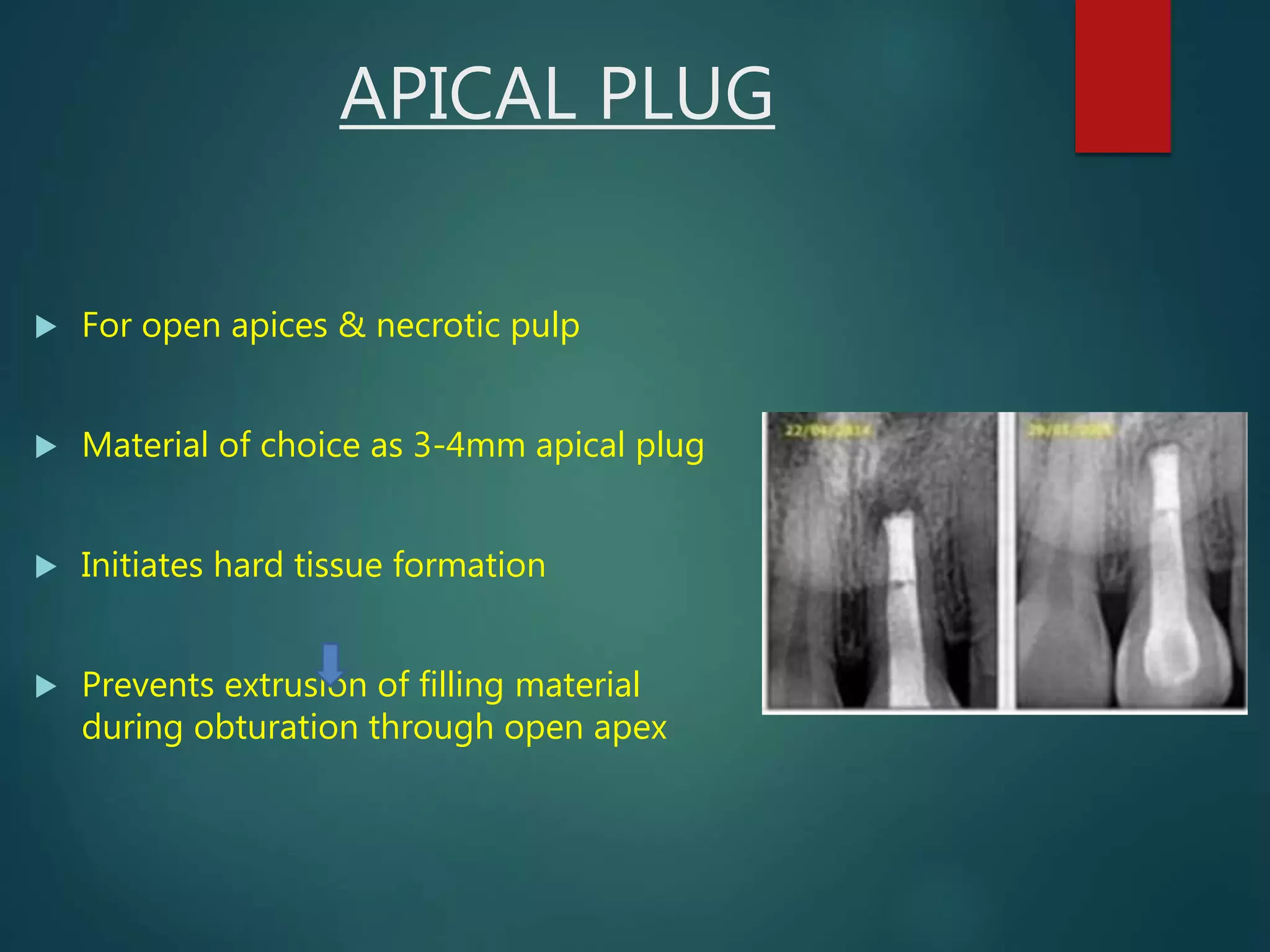 MTA and Biodentin | PPTX