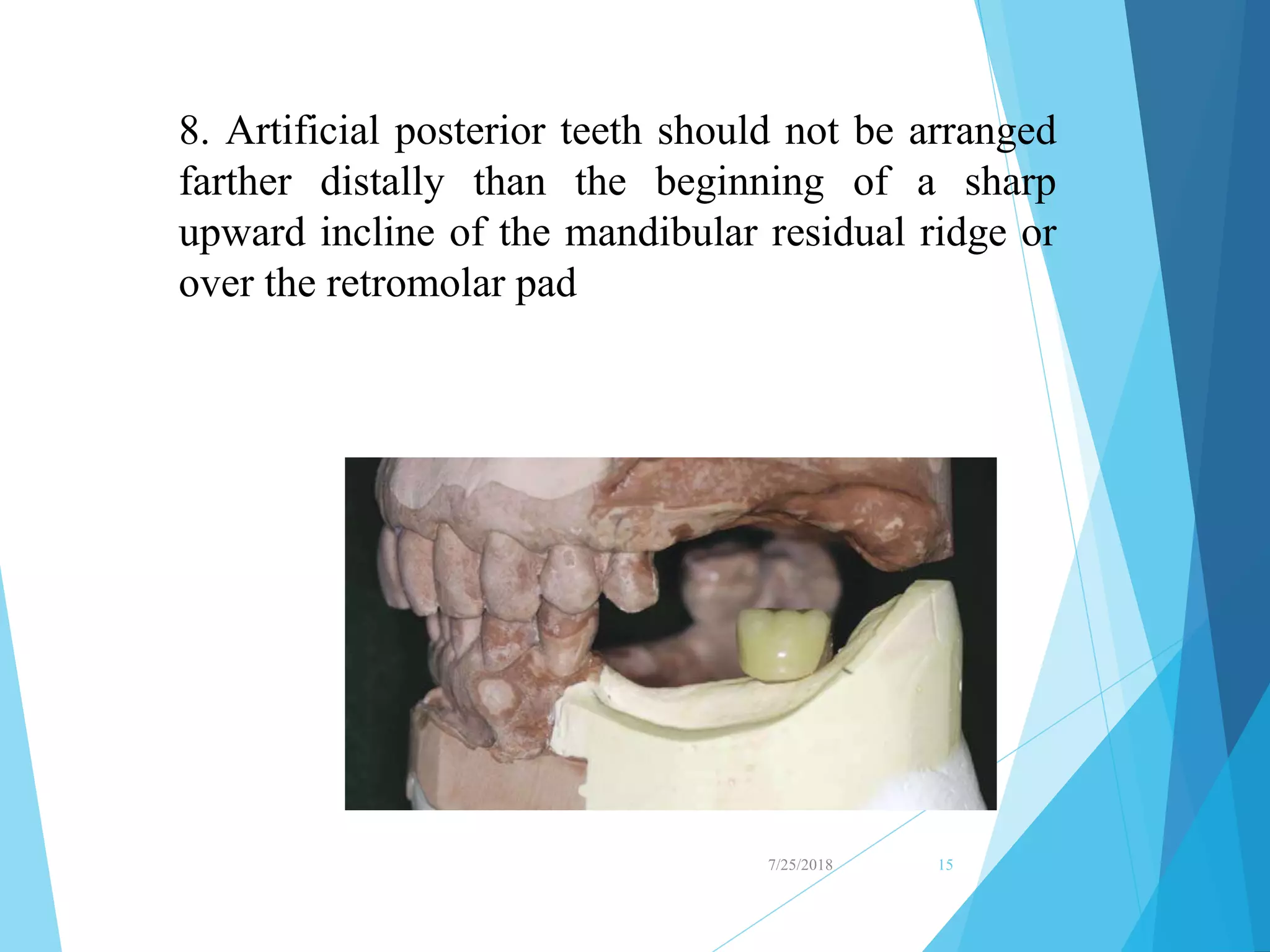 occlusion in rpds | PPTX