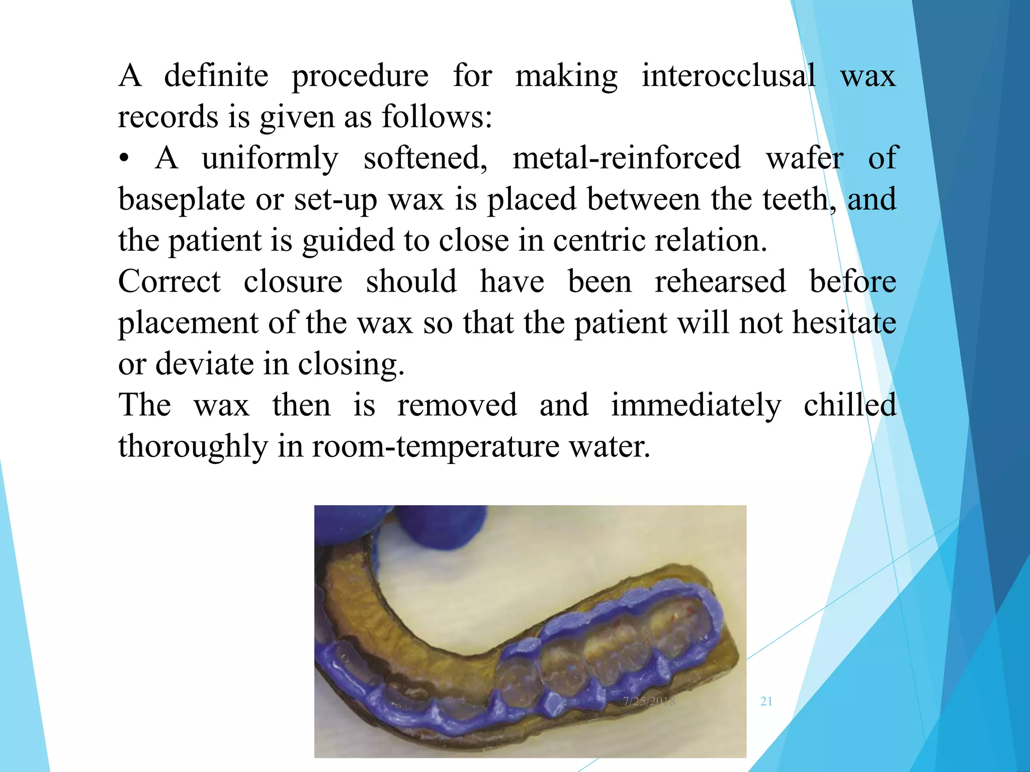 occlusion in rpds | PPTX