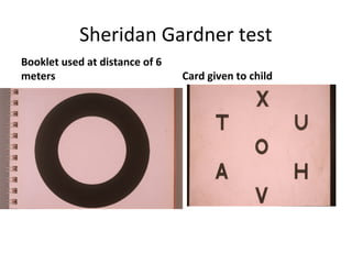 paediatric ophthalmology and strabismus | PPT