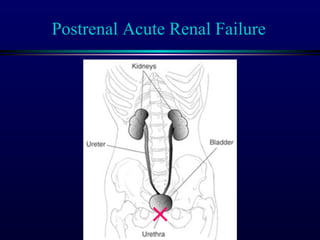 10 Palevsky Acute Renal Failure | PPT